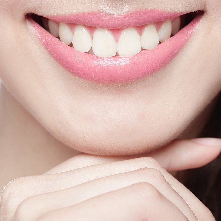 Hollywoodi mosolytervezés | Jókai Dental Budapest